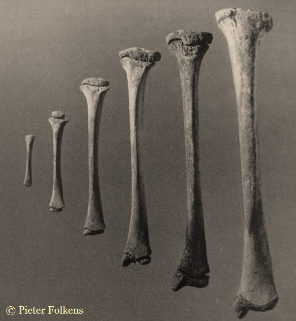 Estimate The Chronological Age Of A Human Skeleton Series – All Things ...