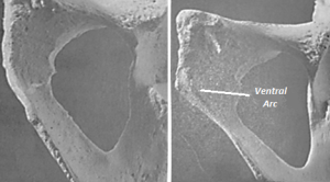 Estimate The Biological Sex Of A Human Skeleton – All Things AAFS!